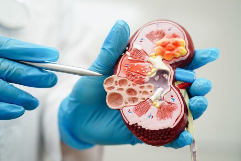 Kidney Disease and Bone Health: The Role of an Orthopedic Specialist